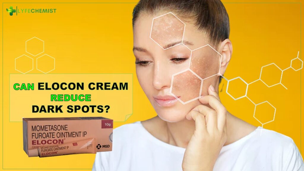 Can Elocon cream reduce dark spots? - LyfeChemist